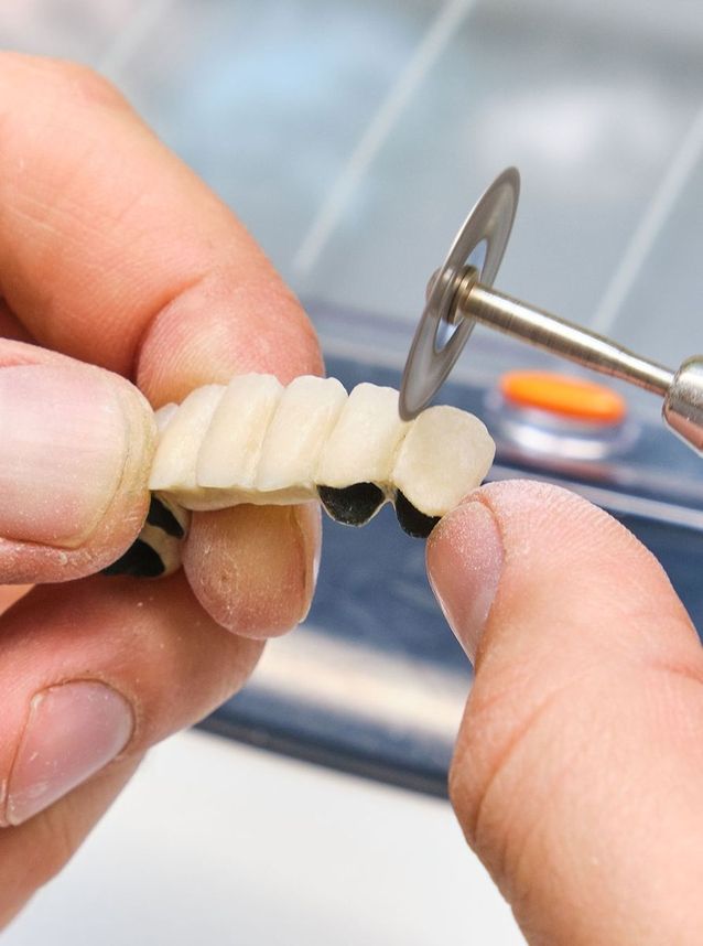 Zahnbrücken in unserer Ordination in Graz